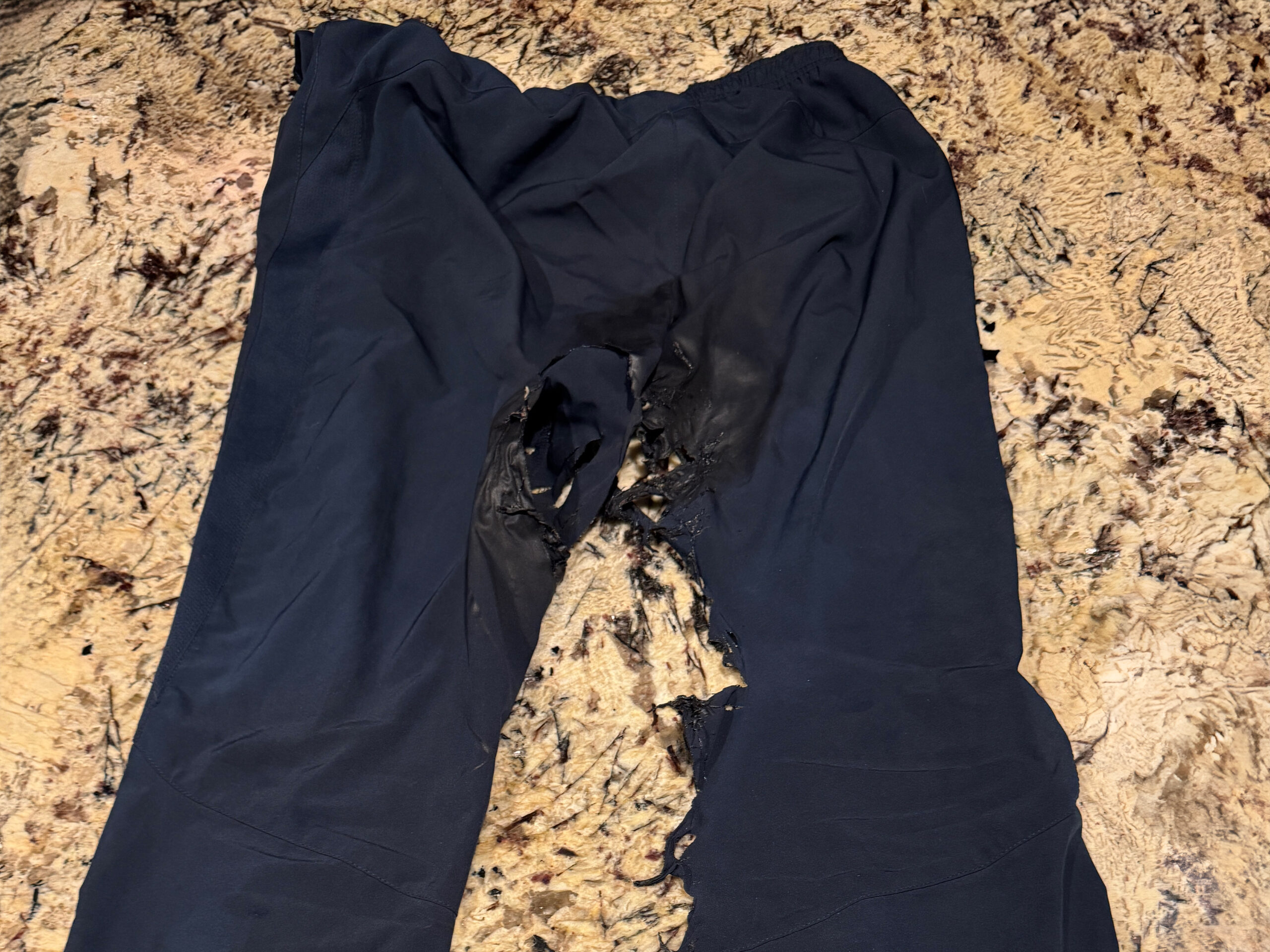 Painful Lessons in Fire Safety and Proper Attire - Hagerty Media